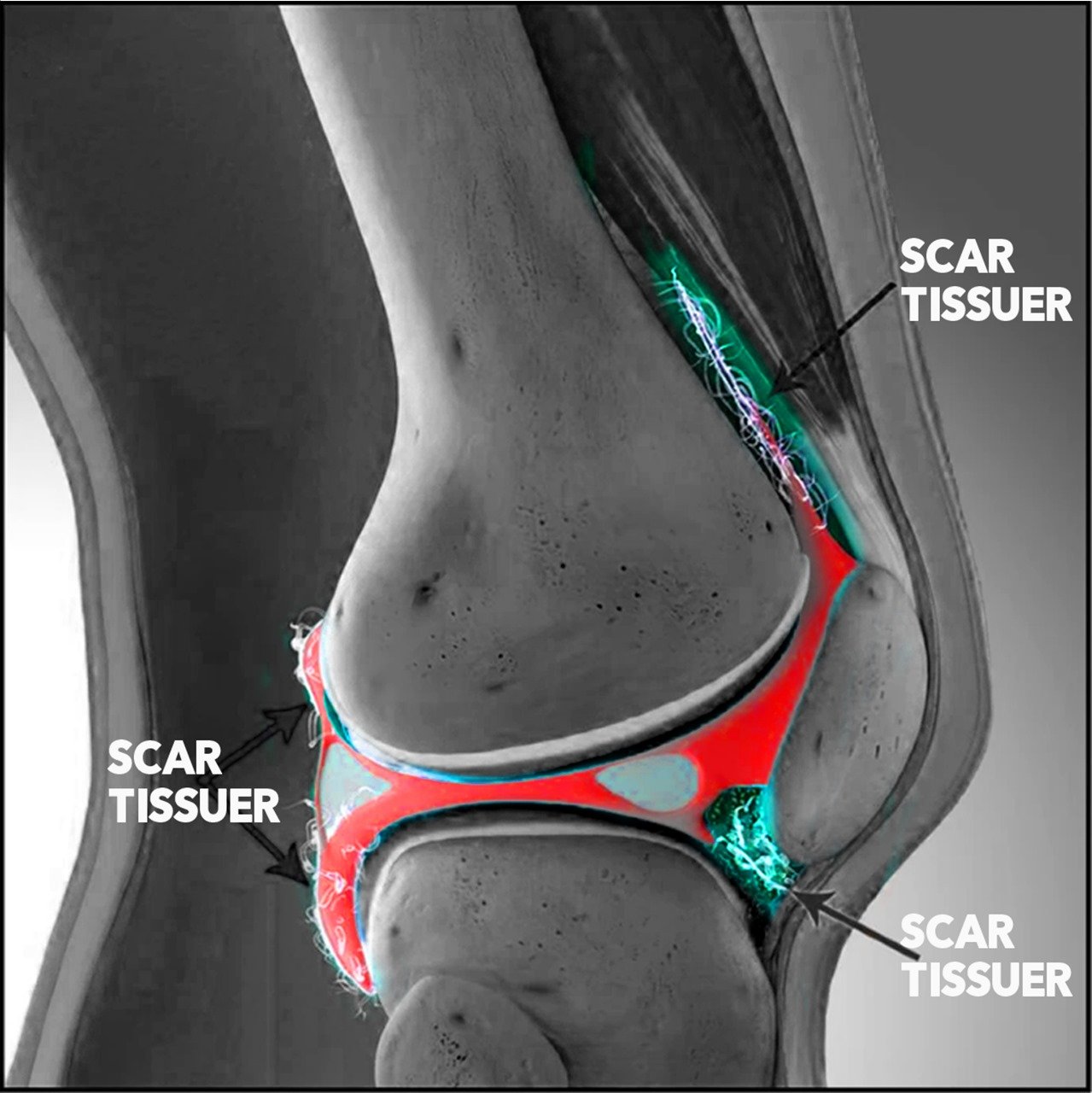 Home - STAK Knee Stretcher